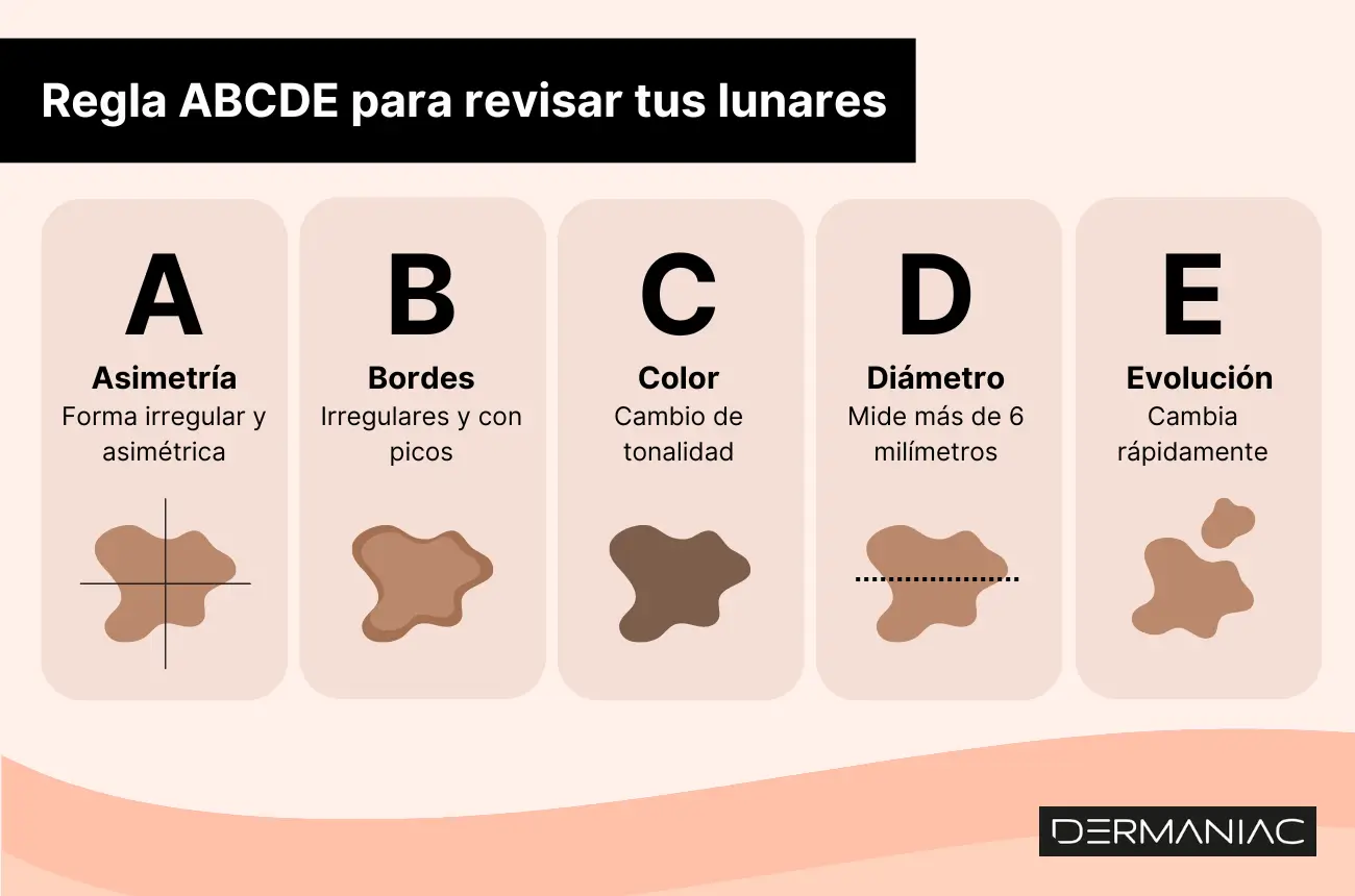 ¿Qué es el melanoma? Reconócelo a tiempo y cuida tu piel | Clínica DERMANIAC Madrid
